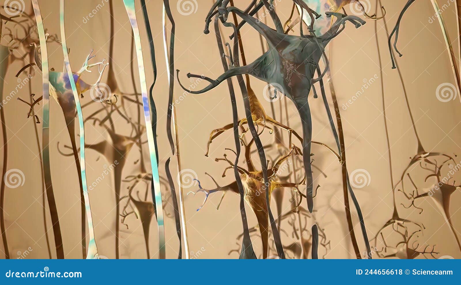 Diffuse Axonal Injury; is Caused by a Combination of Acceleration ...