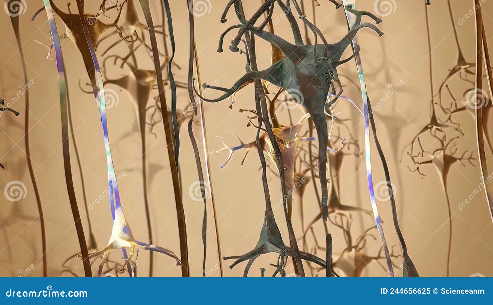 Diffuse Axonal Injury; is Caused by a Combination of Acceleration ...