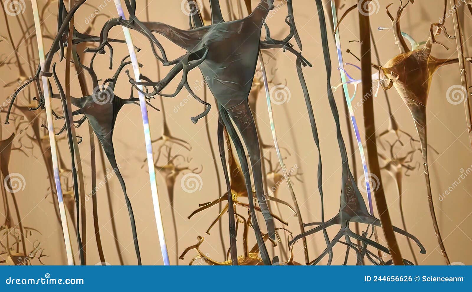 Diffuse Axonal Injury; is Caused by a Combination of Acceleration ...