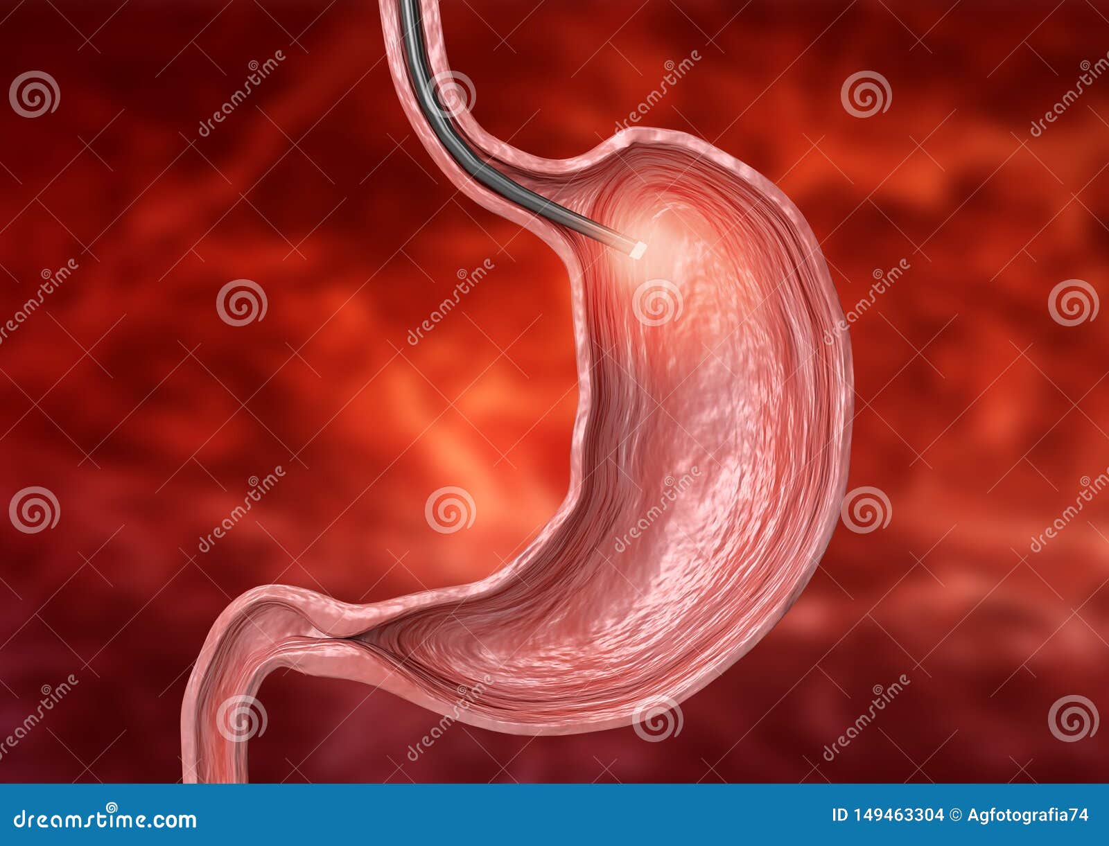 Gastroenterologist Using Digital X-ray Of Human Intestine Holographic ...