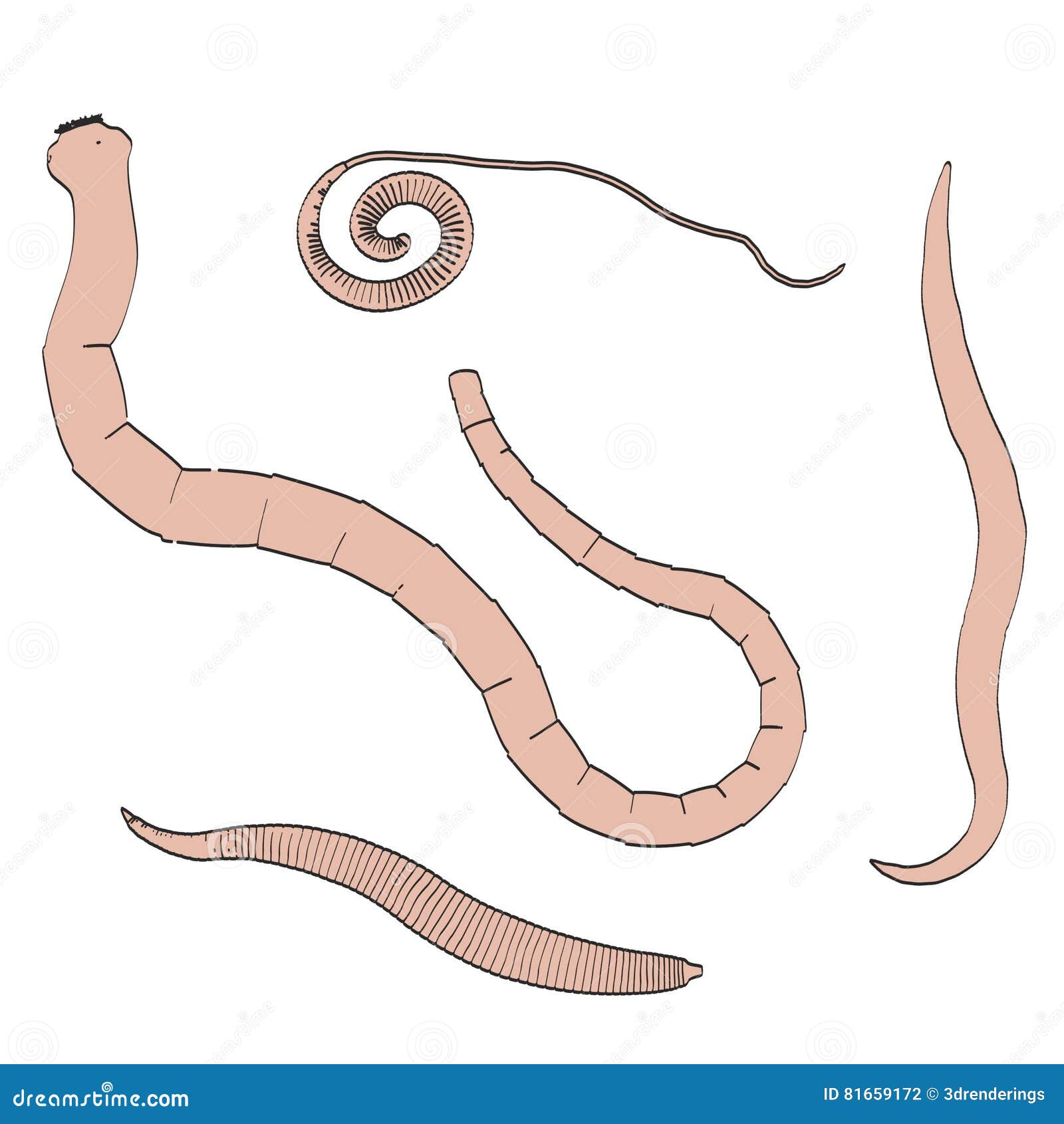 Parasites In Intestines. Indigestion, Germs, Infection And Viruses In ...