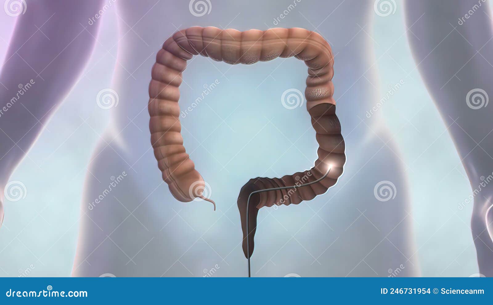 Digestive System, Colonoscopy Stock Illustration - Illustration of ...