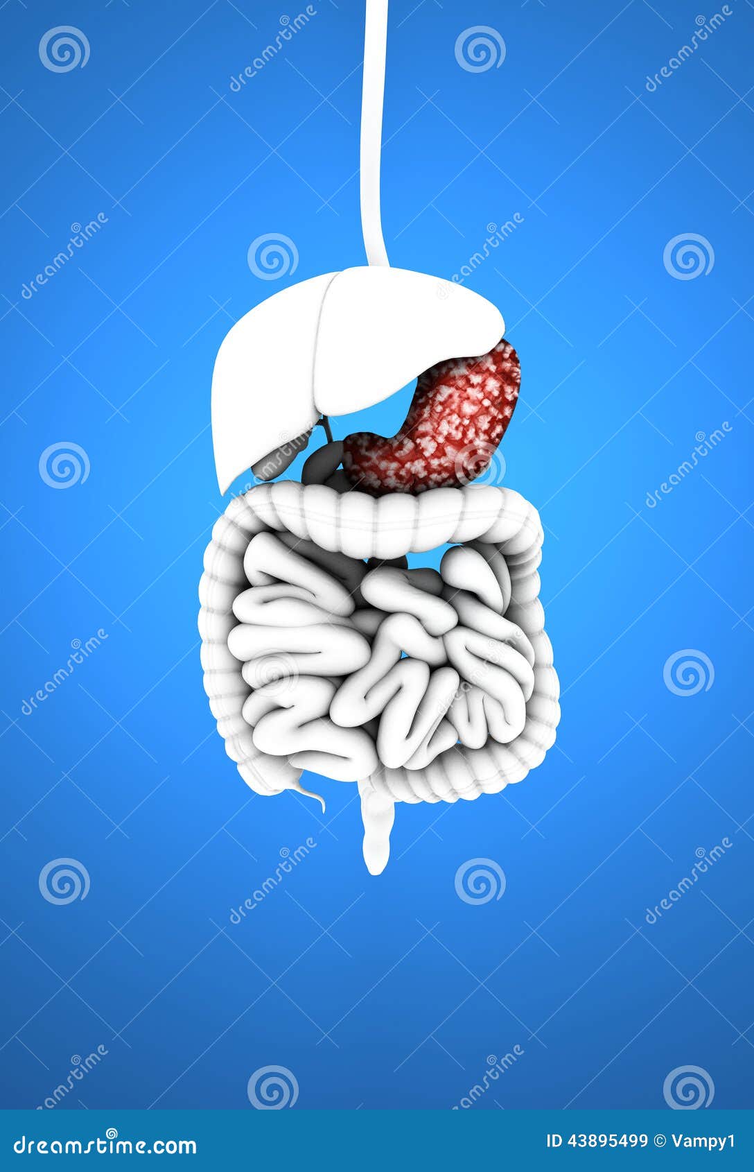 Digestive Tract, Stomach and Ulcers, Stock Illustration - Illustration ...