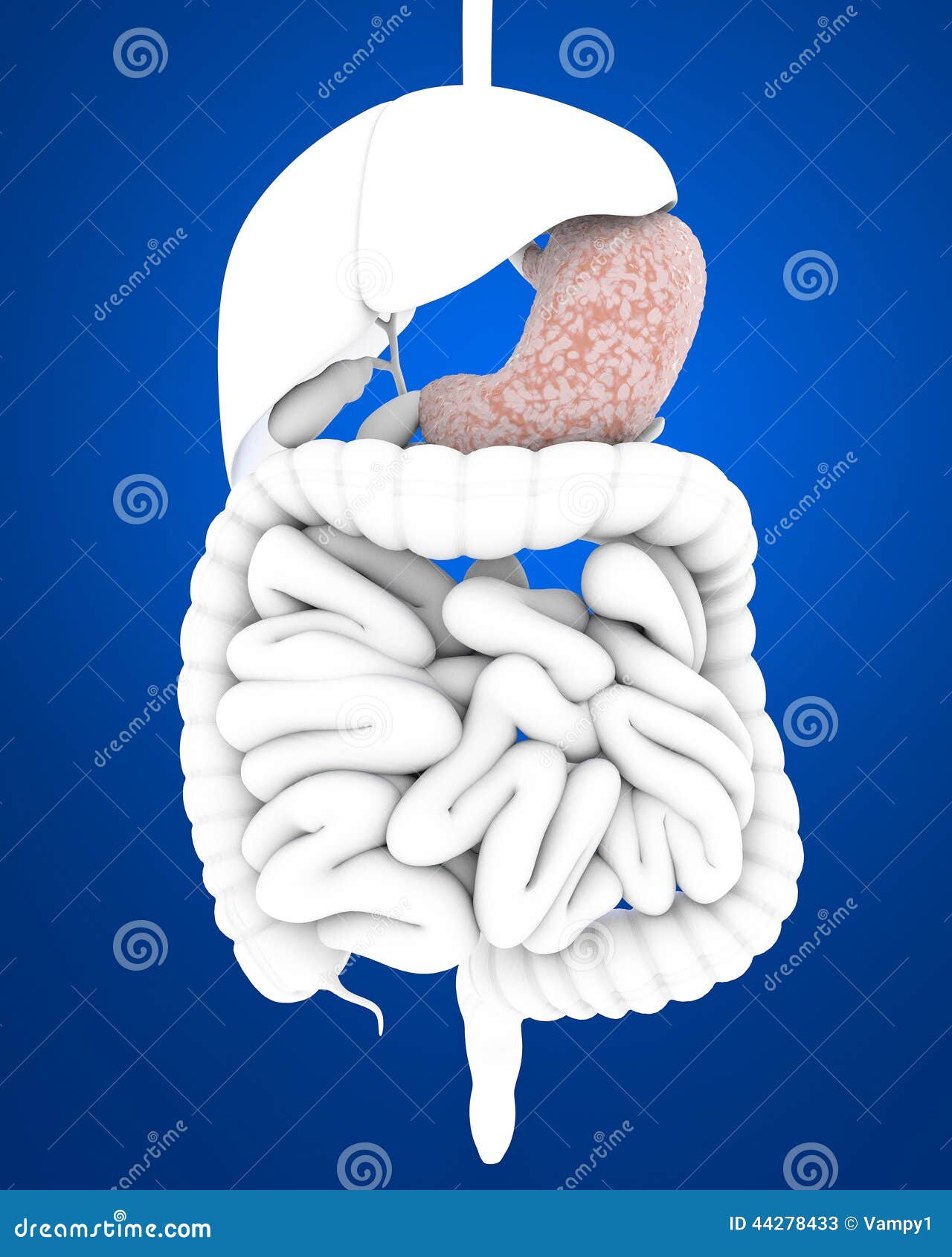 Digestive Tract, Stomach and Ulcers, Stock Illustration - Illustration ...