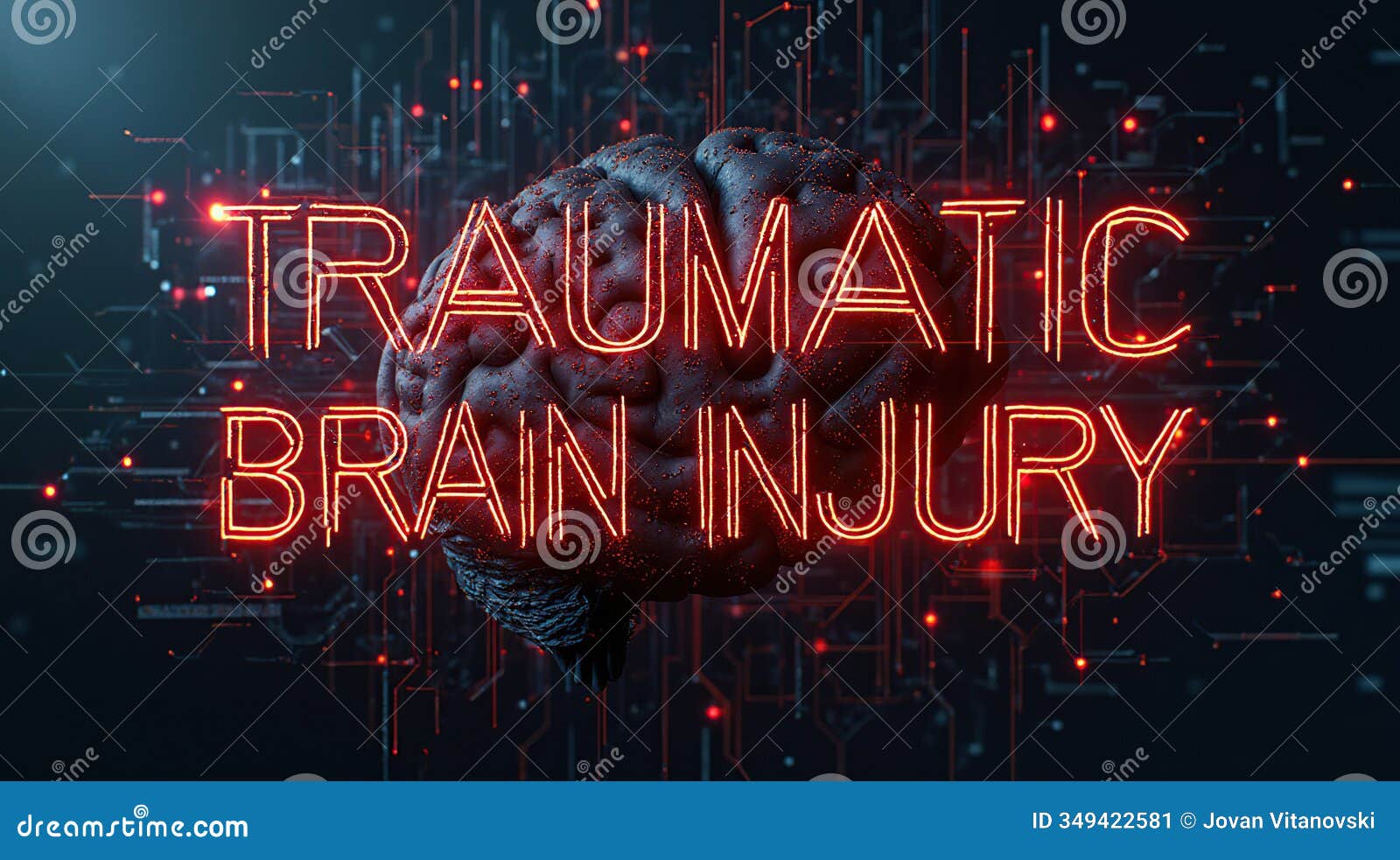 Digital Depiction of Traumatic Brain Injury with Circuit Design Stock ...