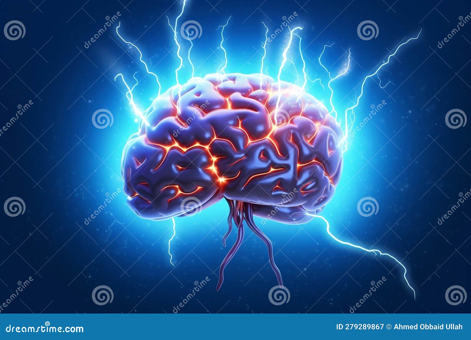 Digital Illustration of Human Brain S Electrical Activity. Generative ...