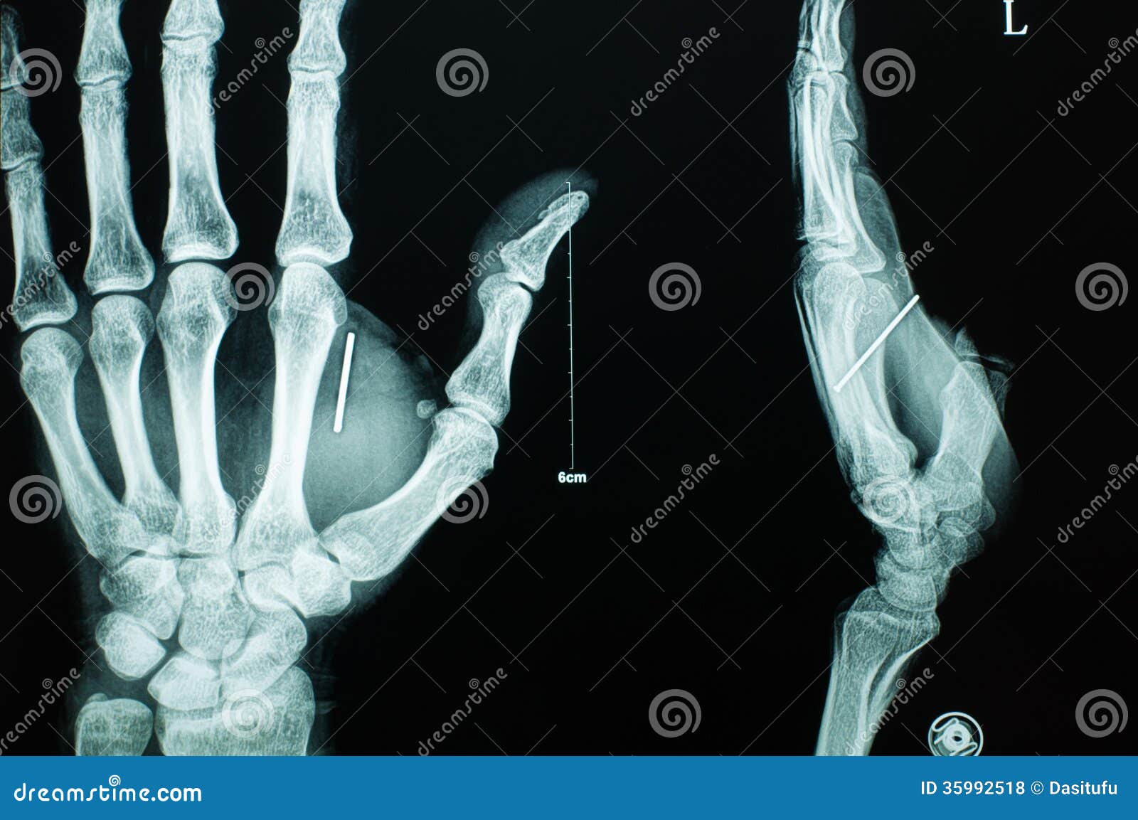 Digital Radiography Stock Photos - Download 879 Images