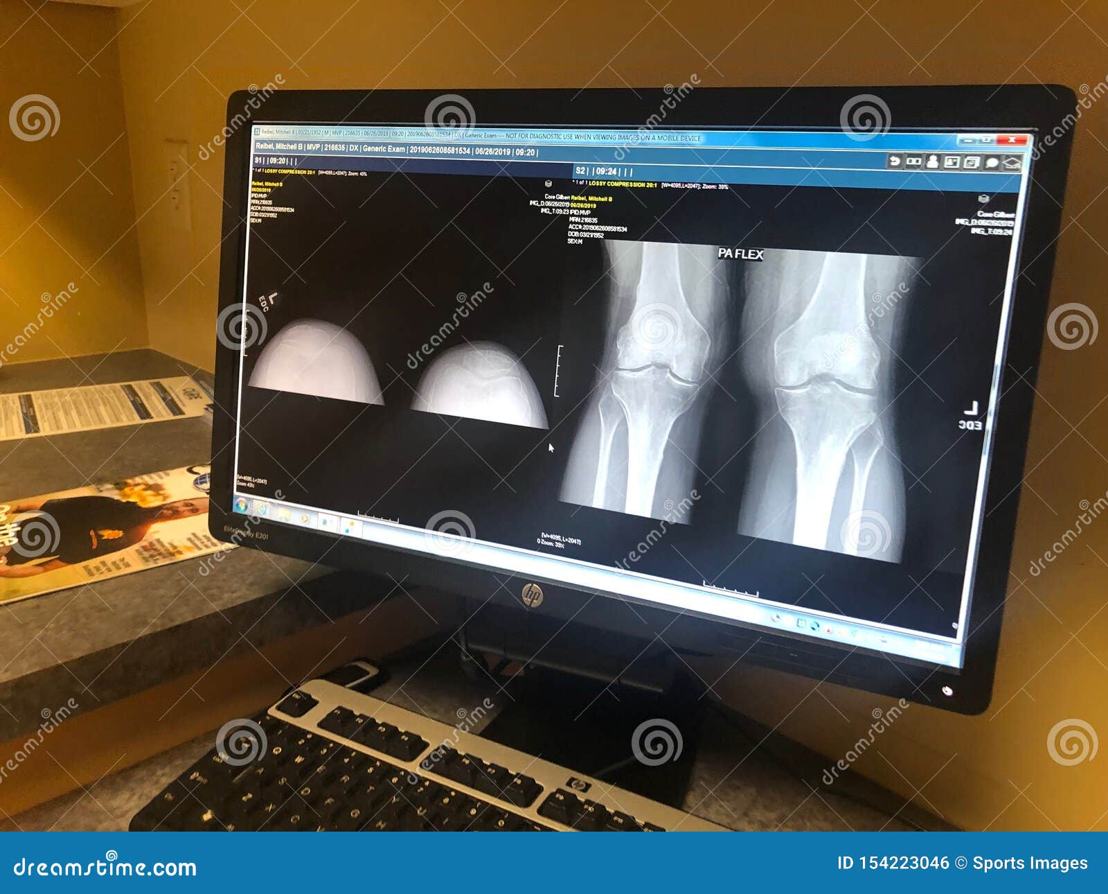 Digital X-Ray editorial photo. Image of screen, xray - 154223046