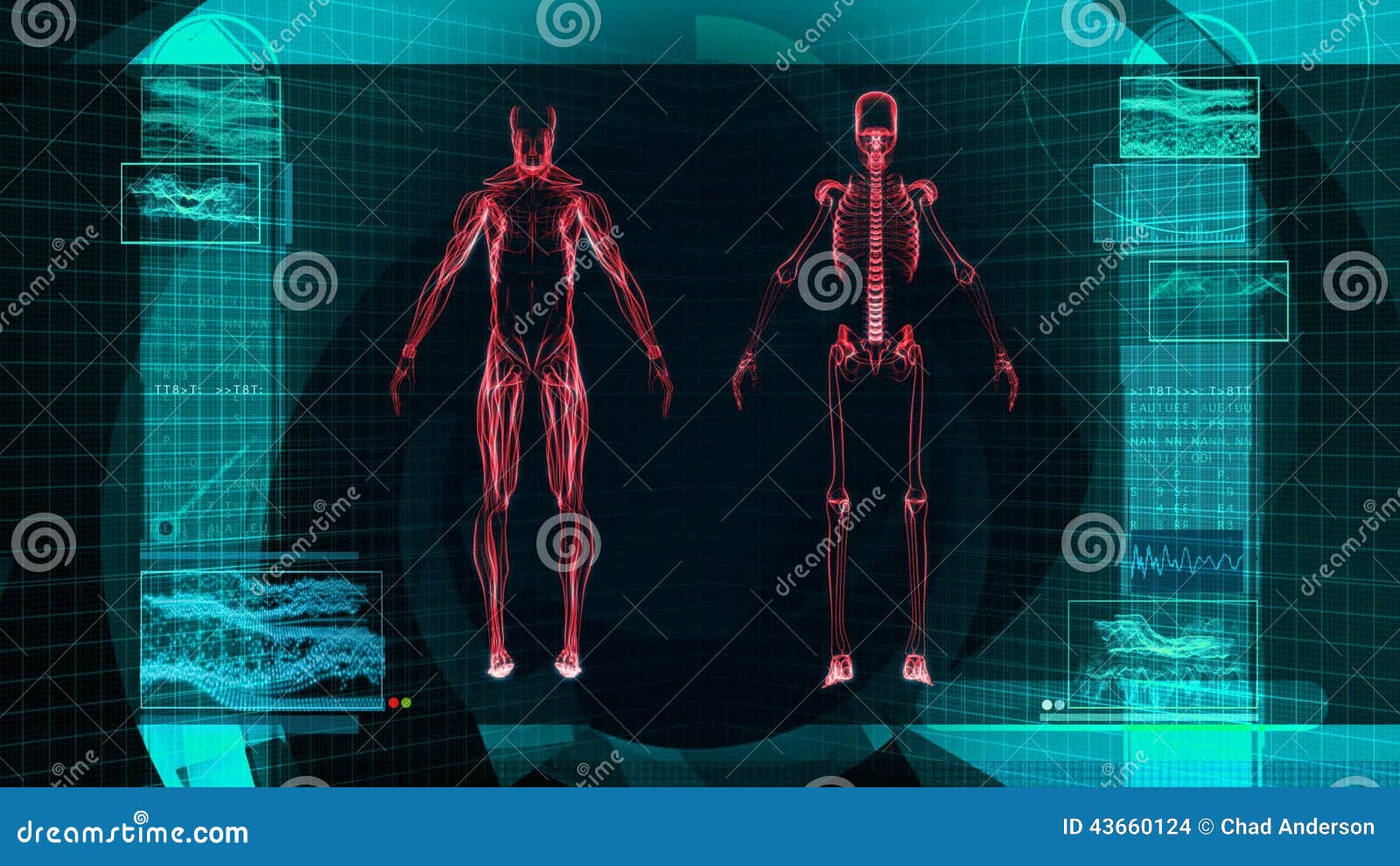 Digital X-Ray Scan of Human Body (HD) Stock Footage - Video of ...