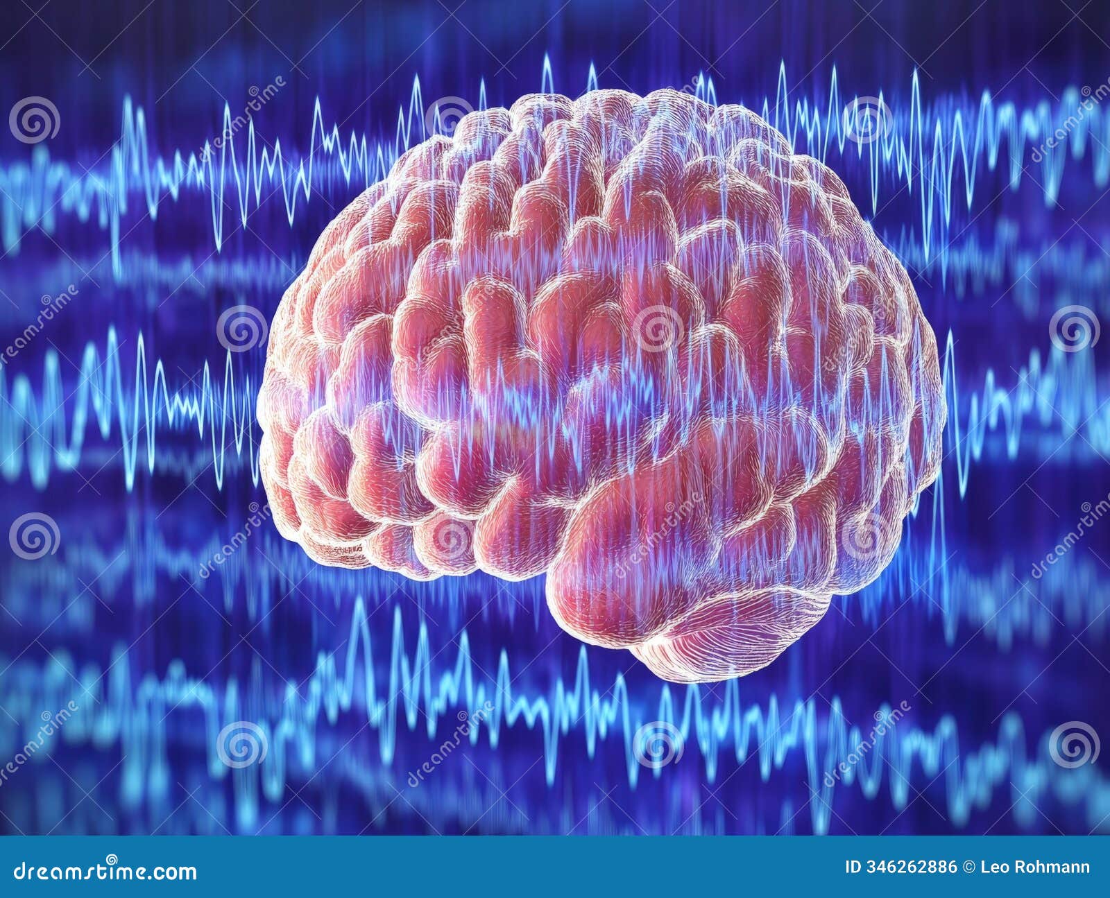 Digital Rendering of a Human Brain Surrounded by Soundwave Patterns ...