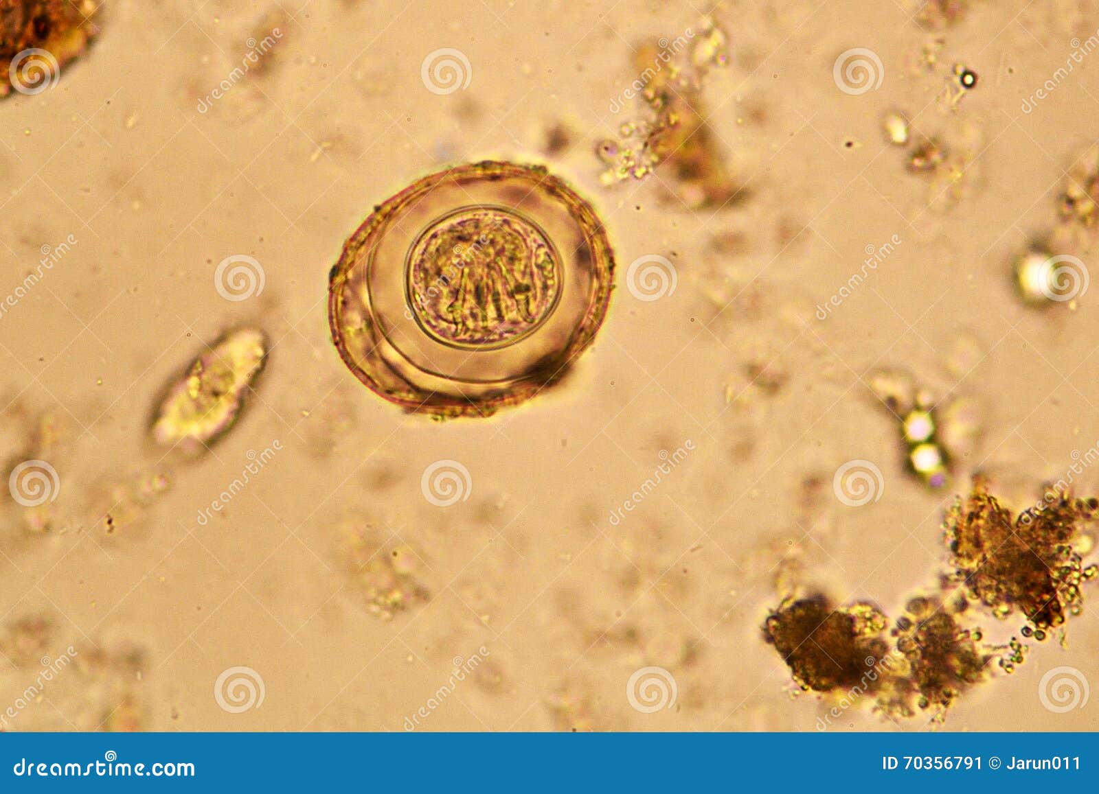 Diminuta de Hymenolepis imagen de archivo. Imagen de microscopia - 70356791