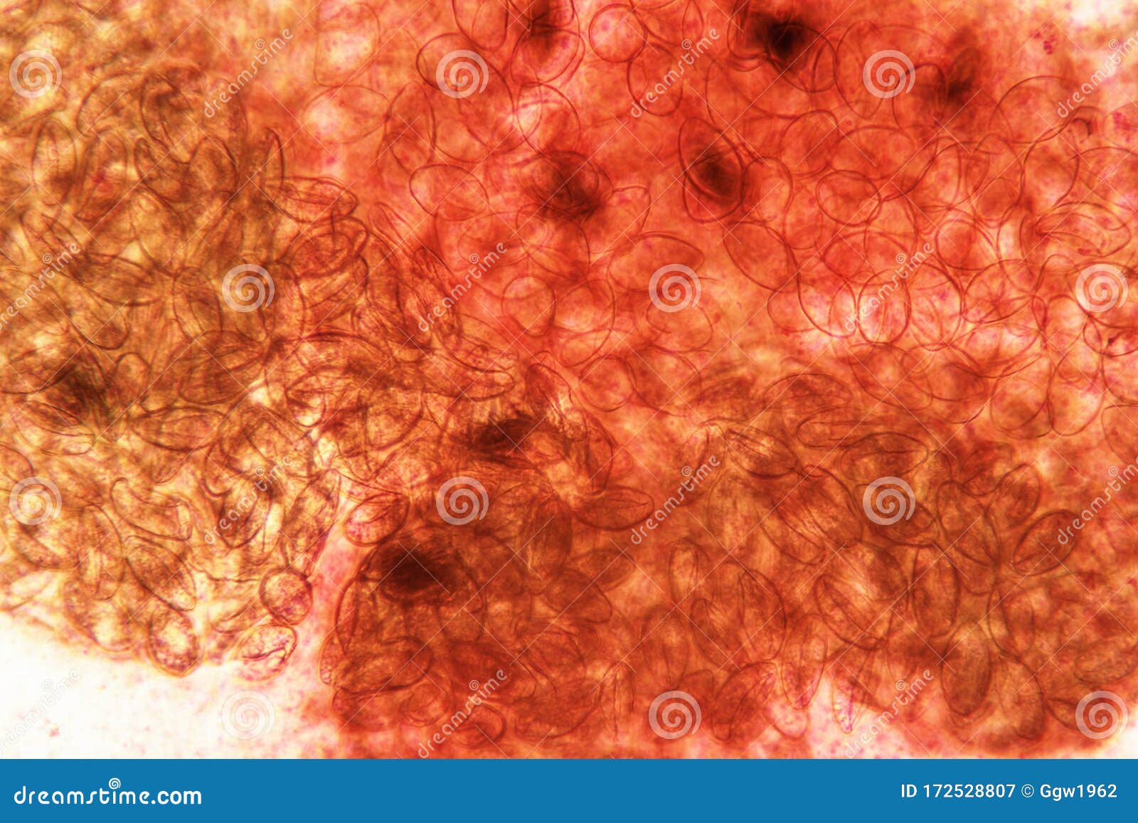 Diphyllobothrium Latum Egg