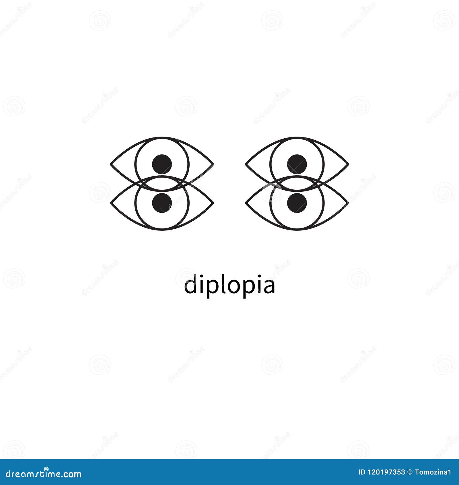 Diplopia Sign, Double Vision Cartoon Vector | CartoonDealer.com #120197353