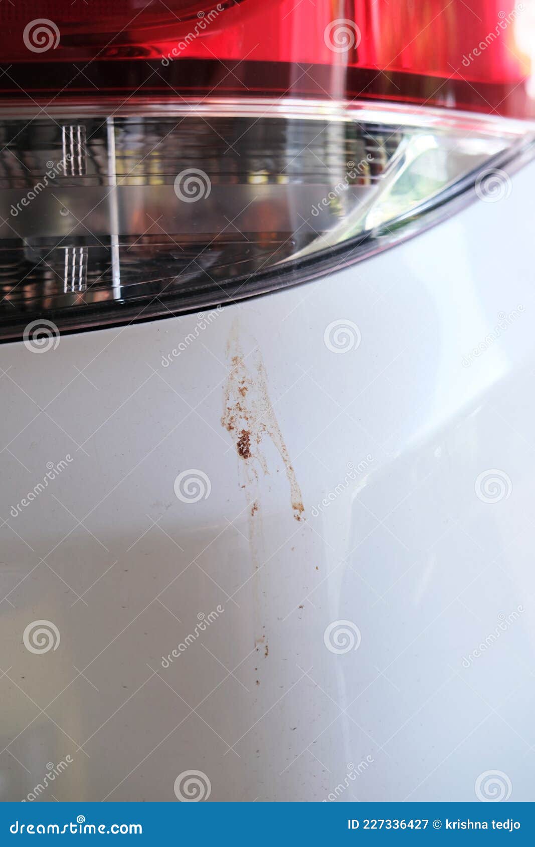 BSA Body Surface Area - Measured Or Calculated Surface Area Of A Human ...