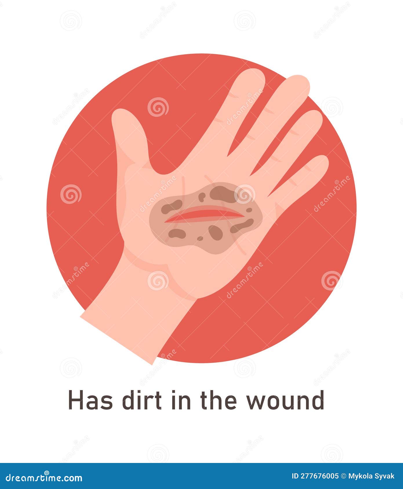 Dirt in the Wound on Hand stock vector. Illustration of stress - 277676005
