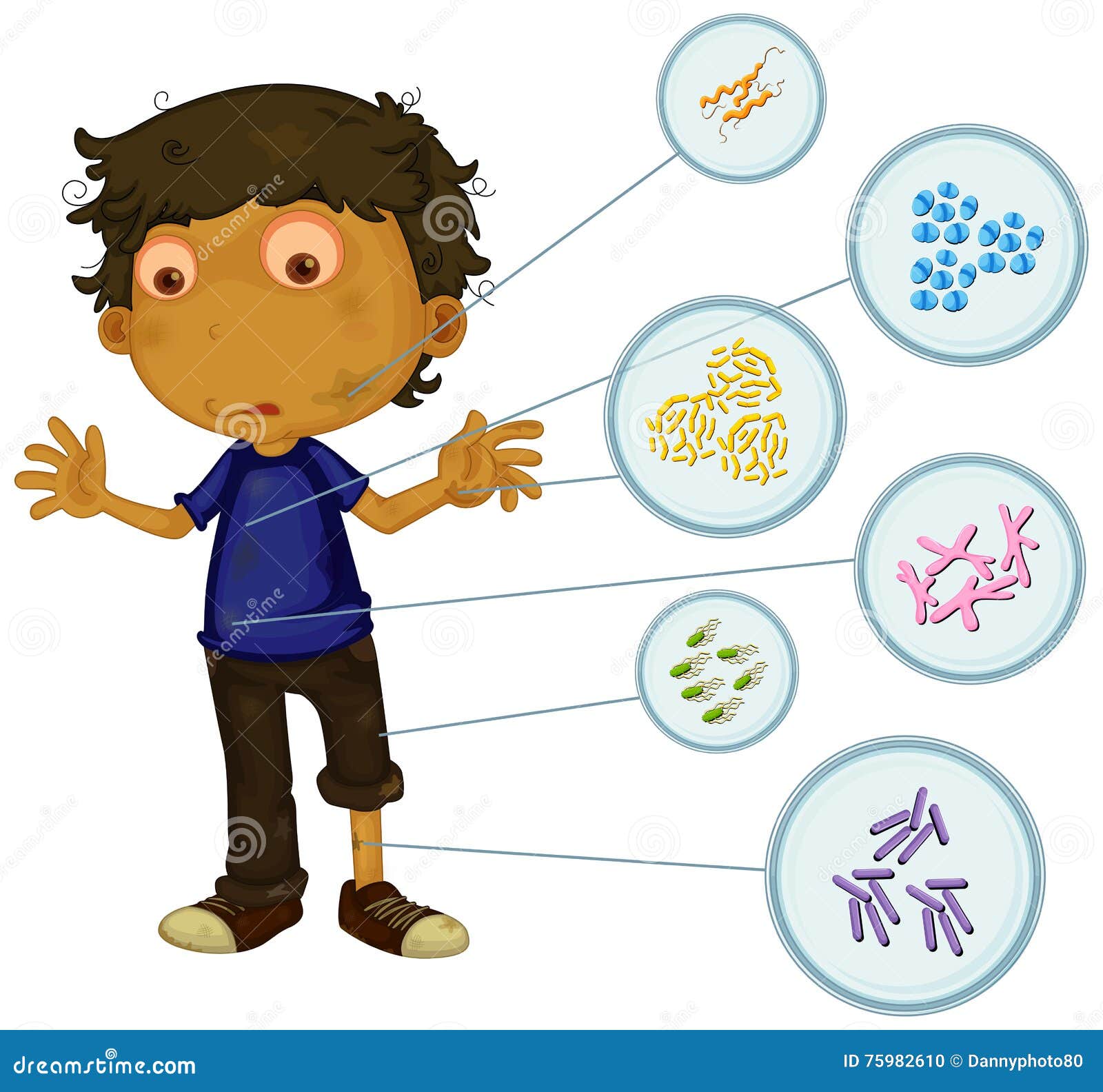 Dirty boy full of bacteria stock vector. Illustration of object - 75982610