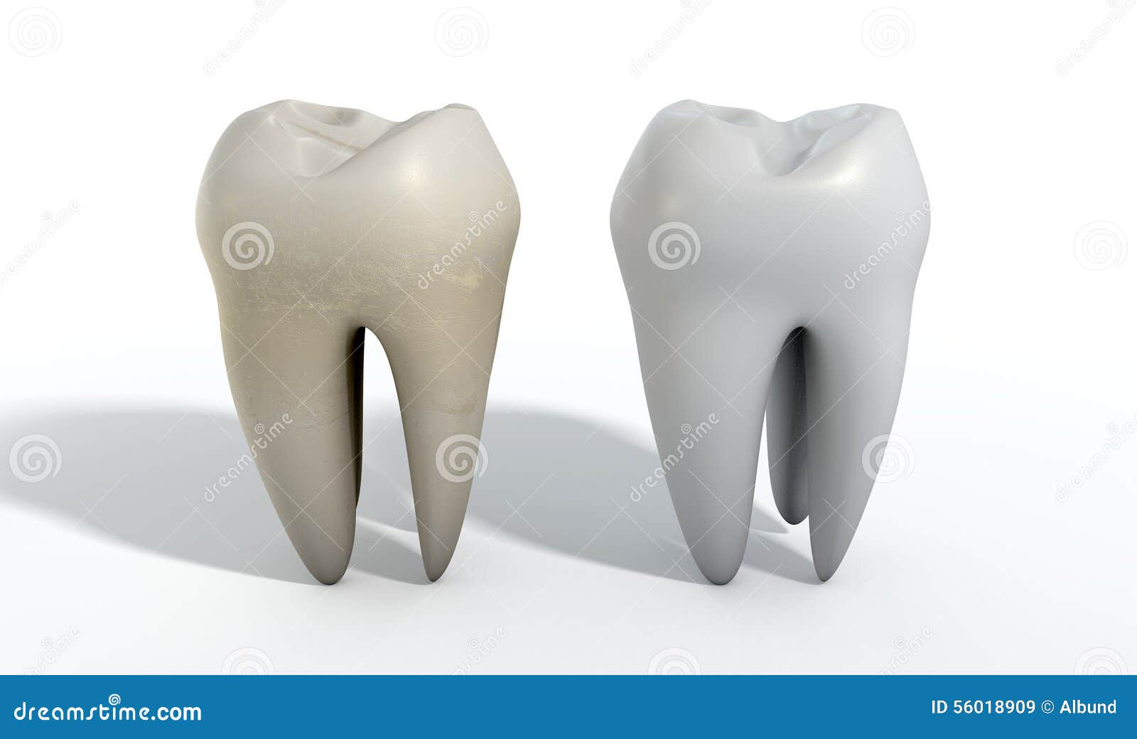 Dirty Clean Tooth Comparison Stock Illustration - Illustration of decay ...