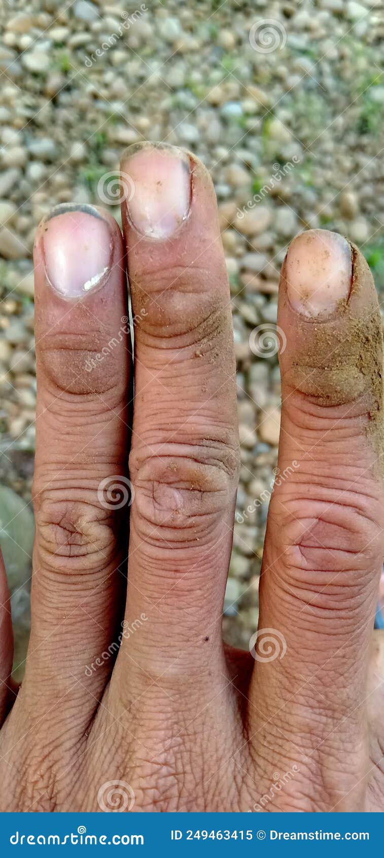 Dirty Fingers, Dirty Long Nails Stock Image - Image of food, leaf ...