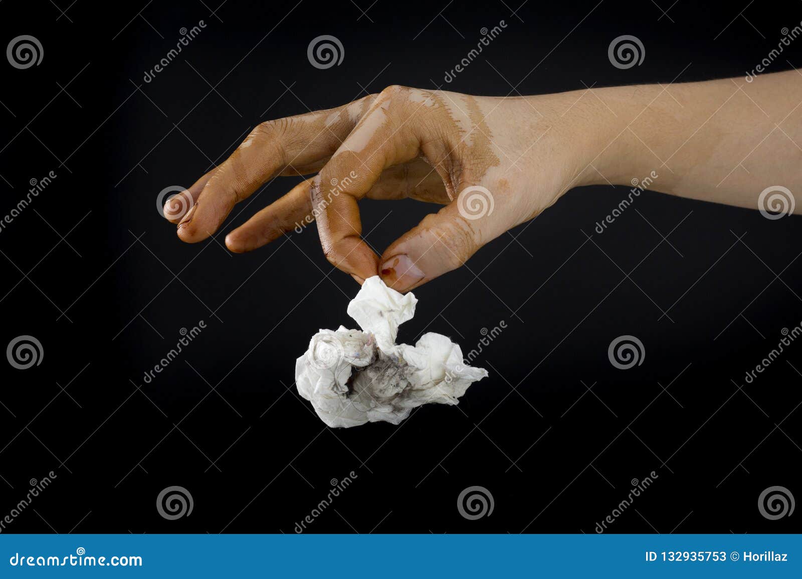 Dirty hand stock image. Image of microbes, hand, infection - 132935753