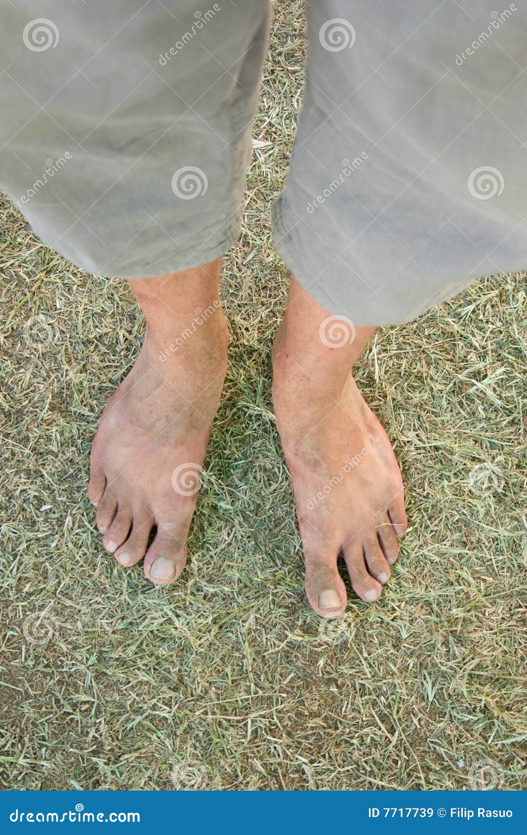 Dirty Legs Picture. Image: 7717739