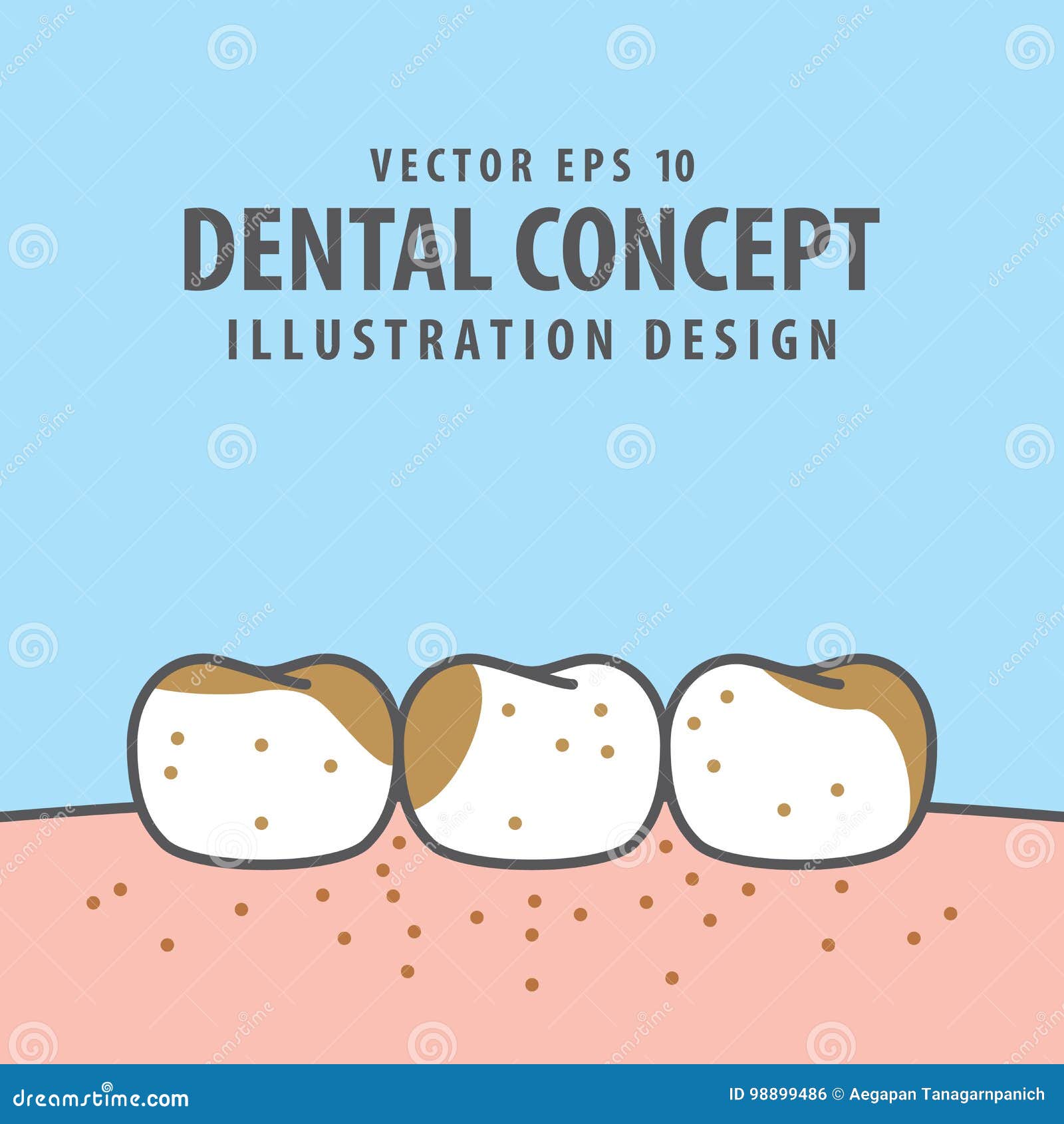 Dirty Teeth Illustration Vector on Blue Background. Dental Conce Stock ...