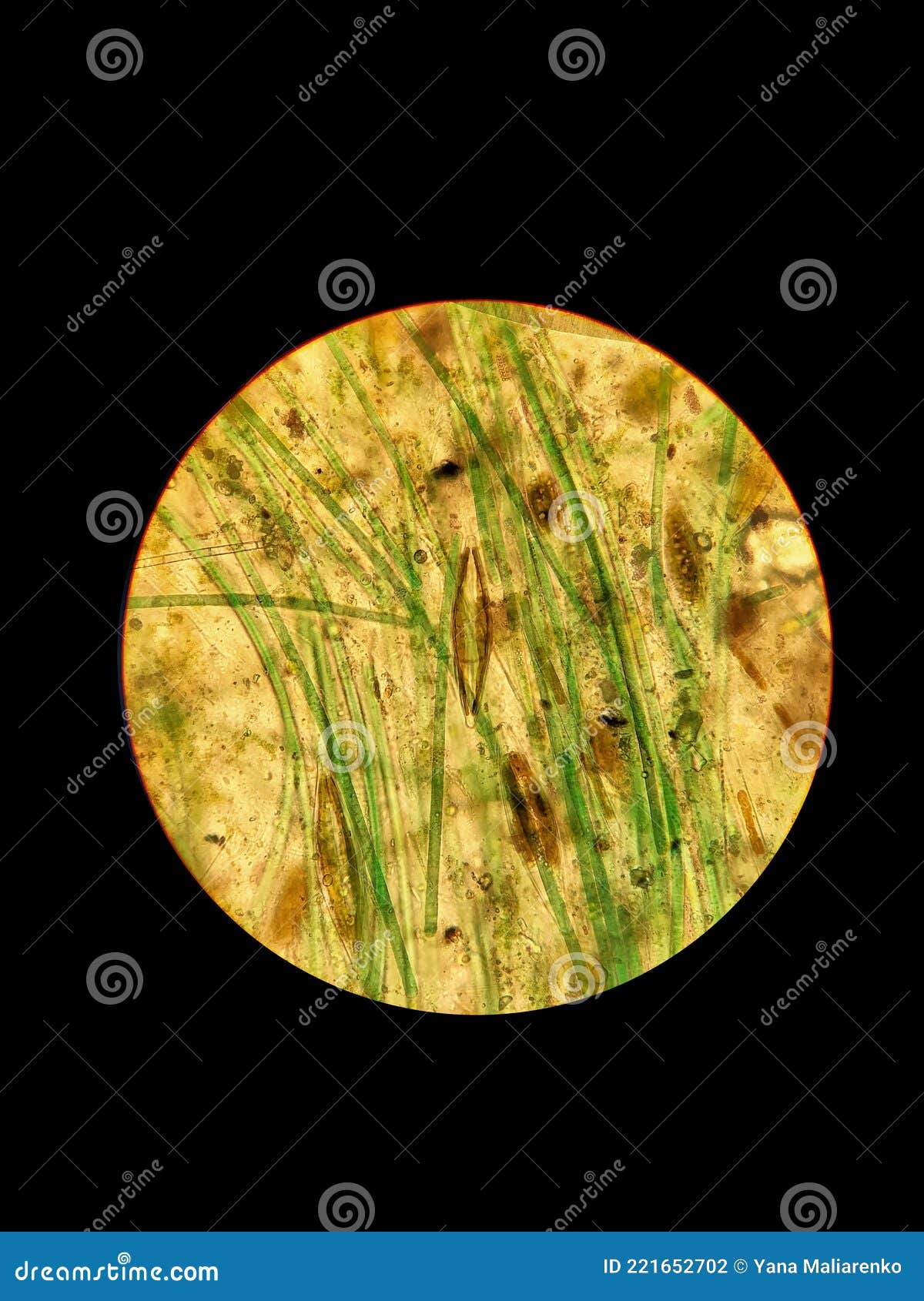 Dirty Water Sample Under a Microscope. Stock Photo - Image of diatoms ...