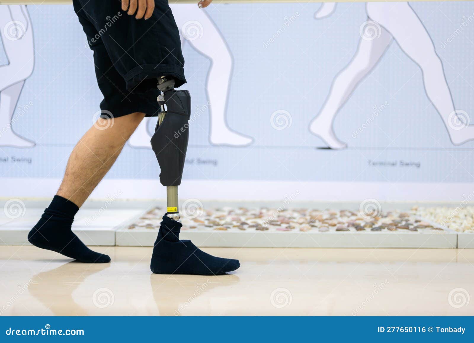 Disabled Athlete Patient with Physical Disability Doing Exercise Stock ...