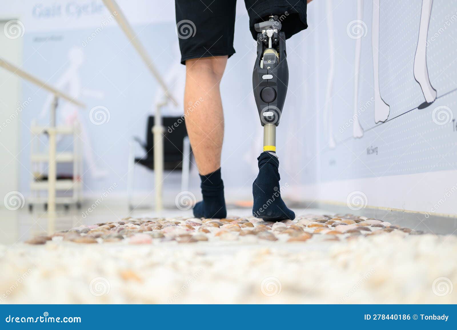 Disabled Athlete Patient with Physical Disability Doing Exercise Stock ...