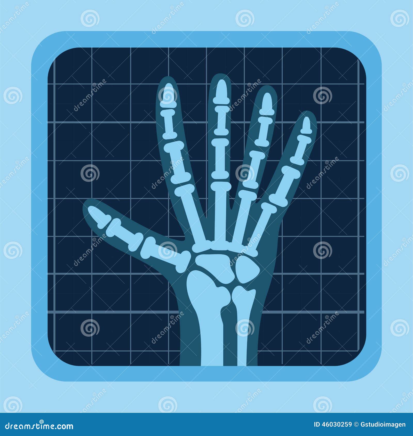 Diseño de los rayos x ilustración del vector. Ilustración de muestra ...