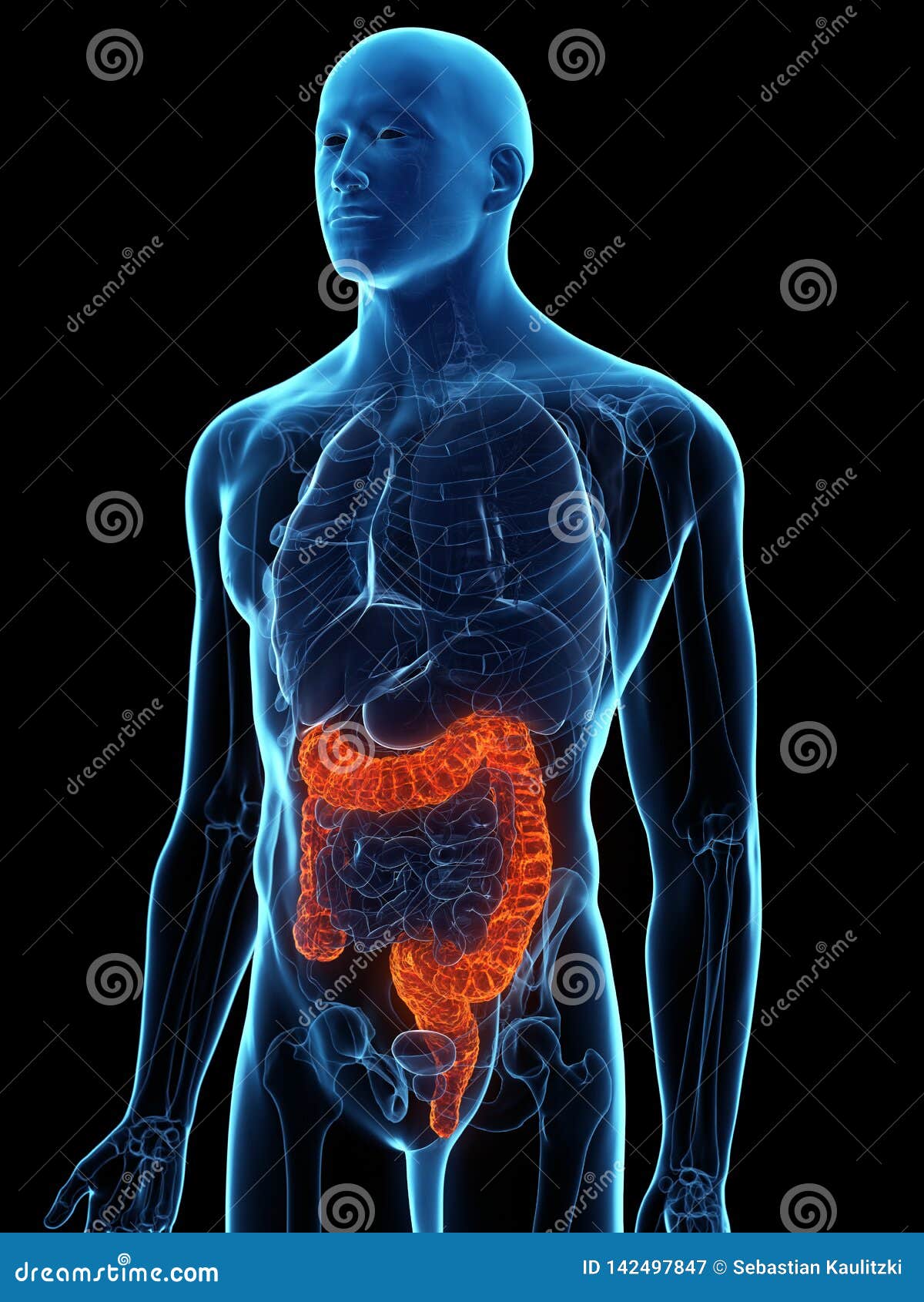 A diseased colon stock illustration. Illustration of large - 142497847