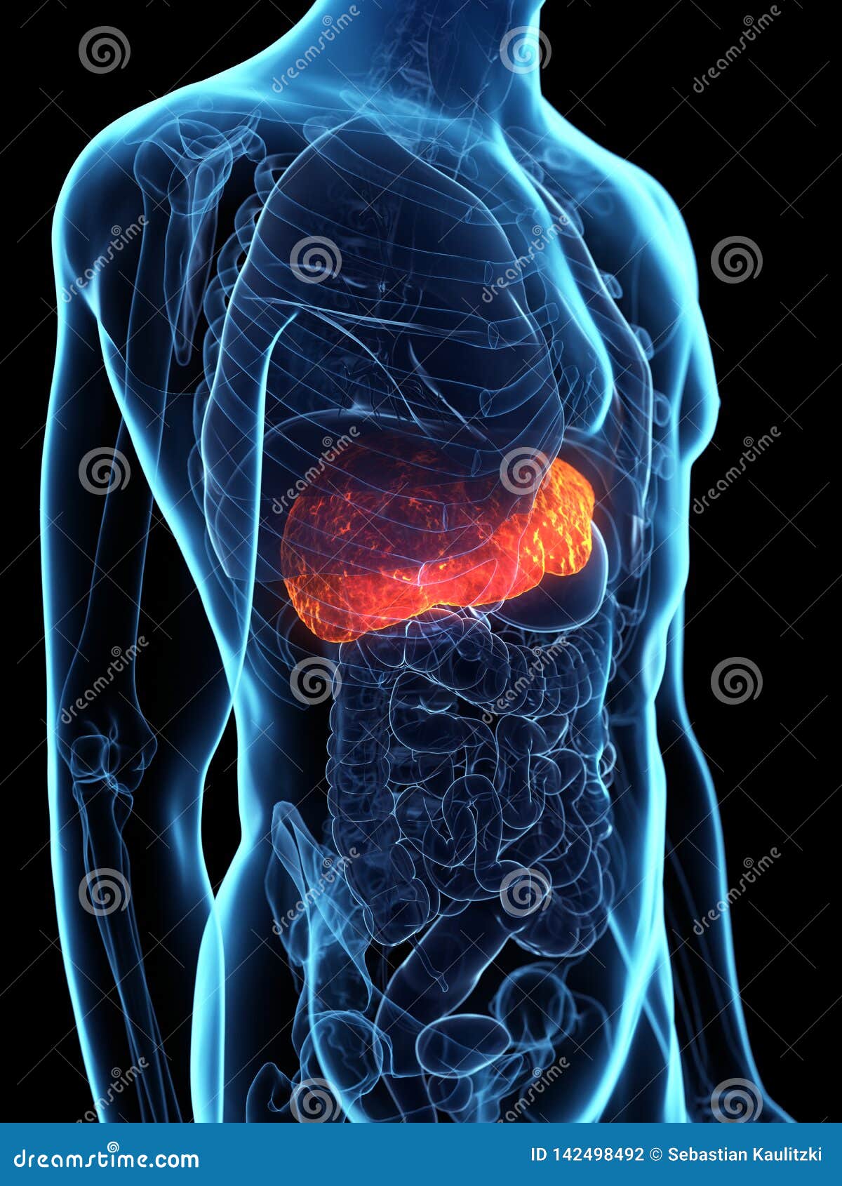A diseased liver stock illustration. Illustration of infection - 142498492
