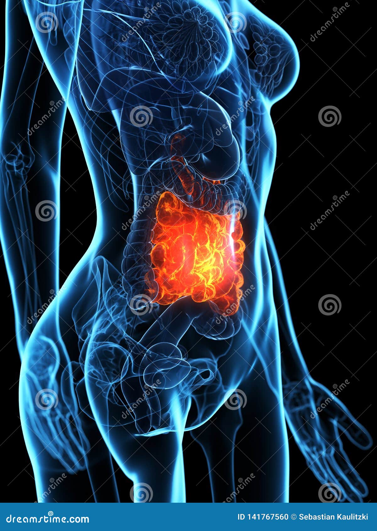 A diseases small intestine stock illustration. Illustration of ...