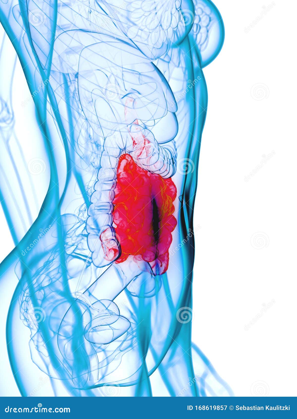 A diseases small intestine stock illustration. Illustration of inside ...