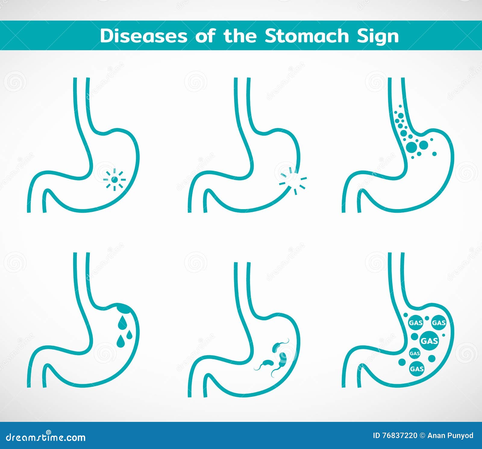 Diseases of the Stomach Sign Vector Set Design Stock Vector ...