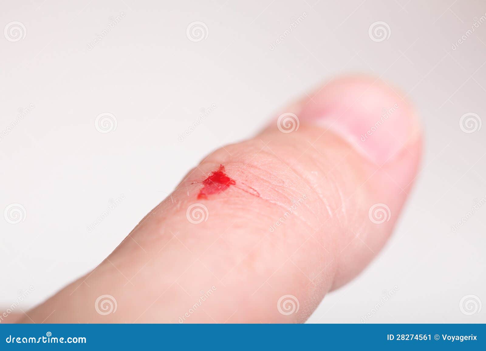 Disinfect the Scratch Alcohol Cuts Hand Health Stock Image - Image of ...