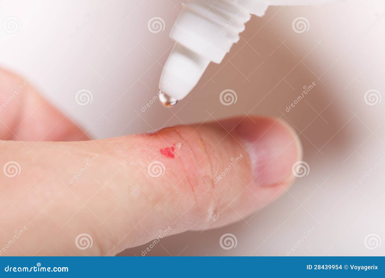 Disinfect the Scratch Alcohol Cuts Hand Health Stock Photo - Image of ...