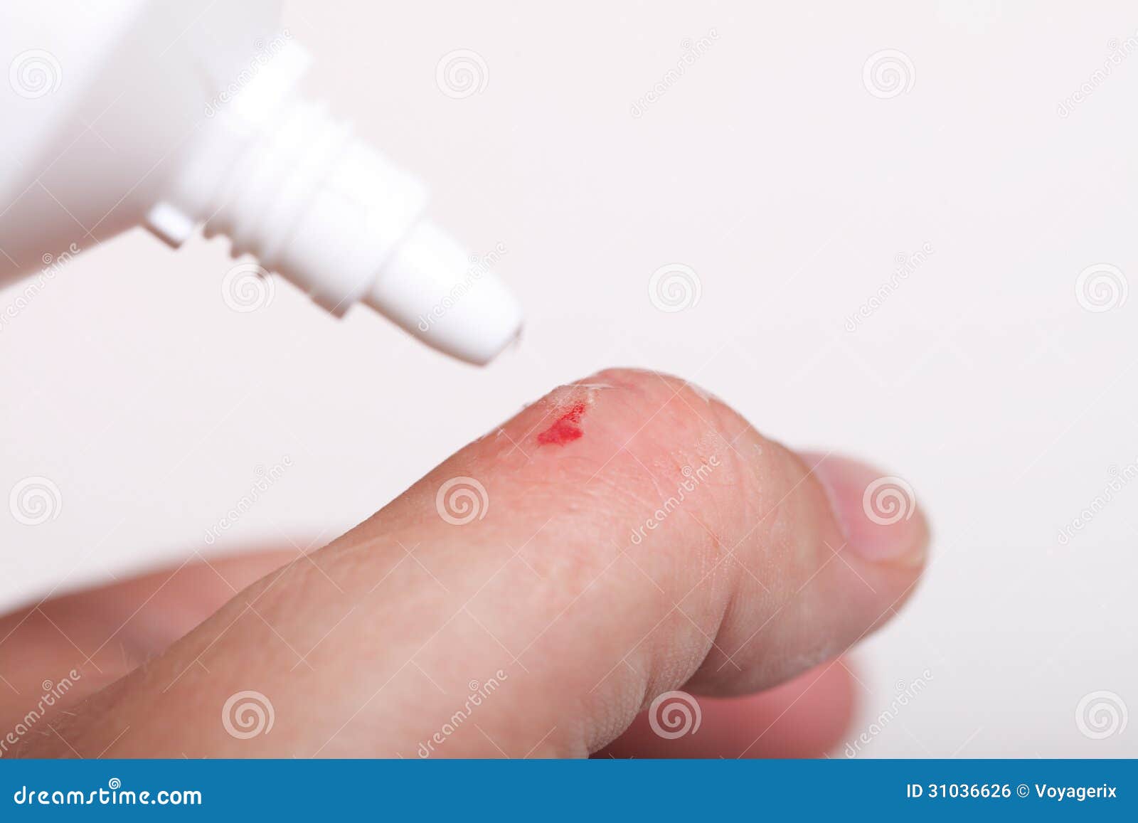 Disinfect the Scratch Alcohol Cuts Hand Health Stock Photo - Image of ...