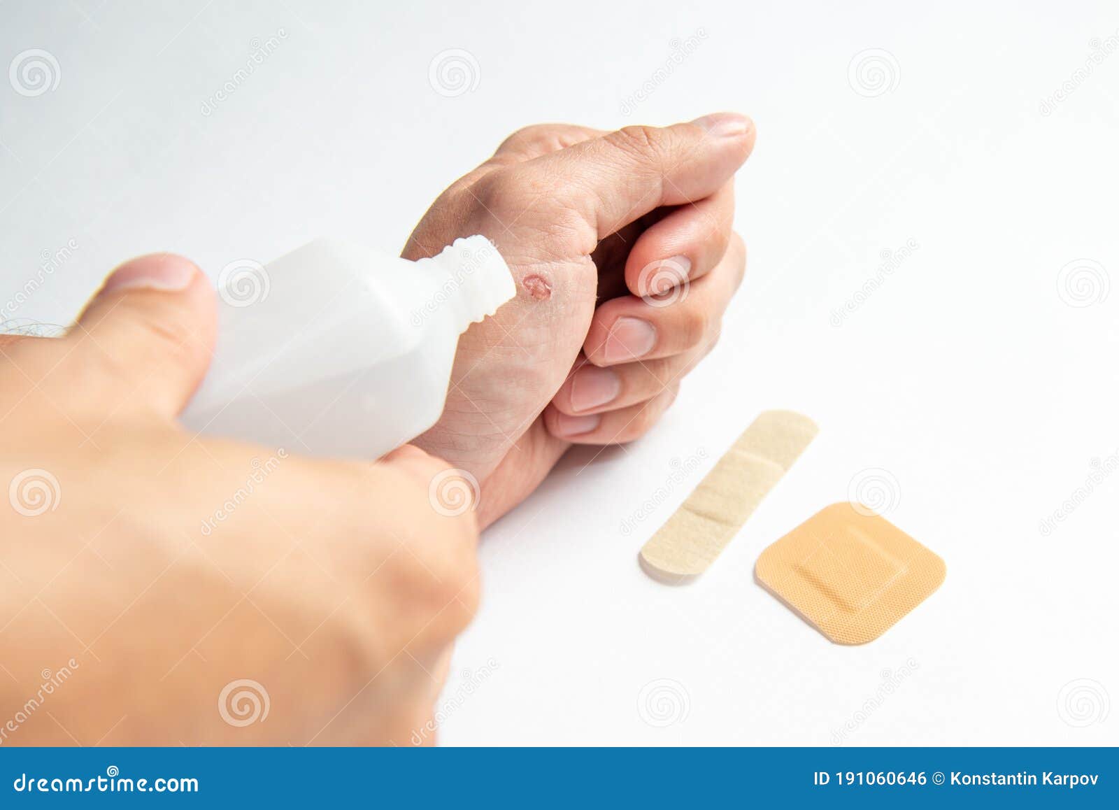 Disinfecting the Wound on the Hand and Applying a Patch Stock Photo ...