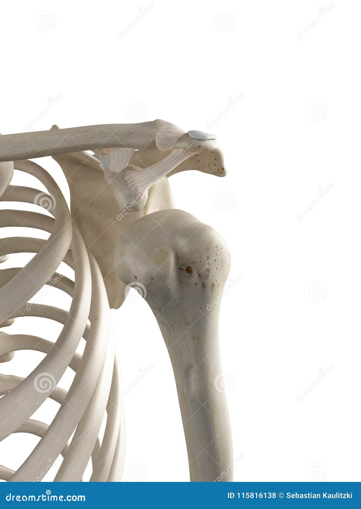 A dislocated shoulder stock illustration. Illustration of shoulder ...