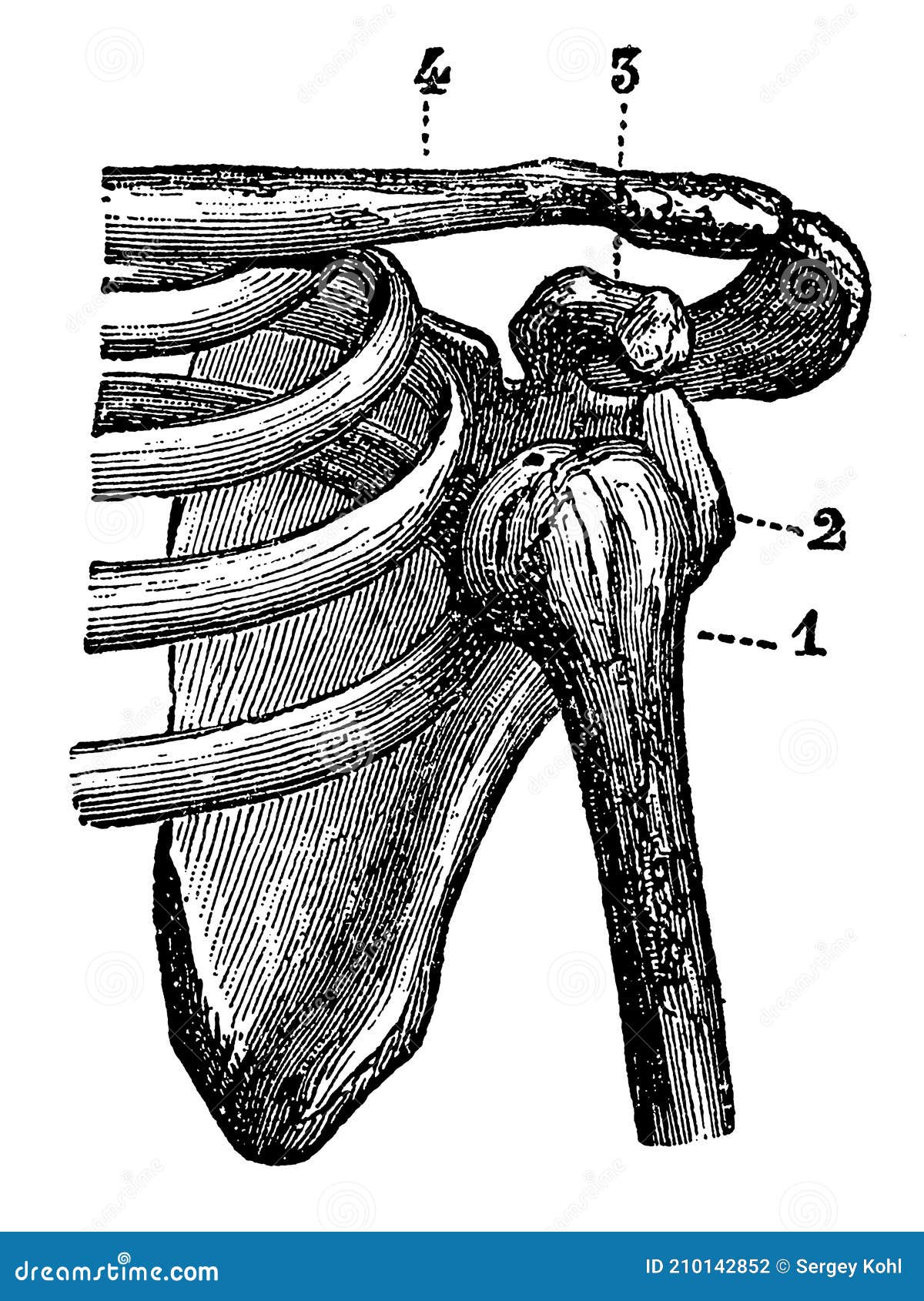 Shoulder Dislocation Cartoon Vector | CartoonDealer.com #53691677