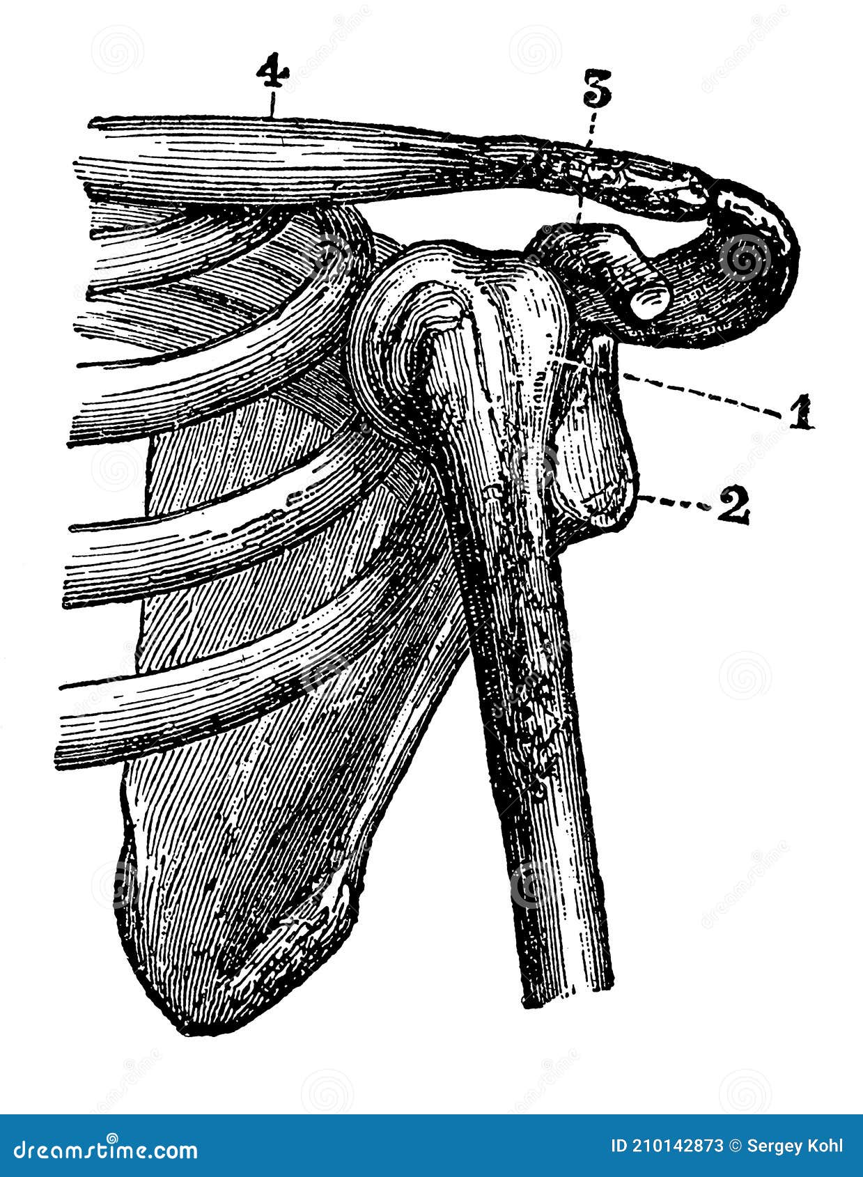 Shoulder Dislocation Cartoon Vector | CartoonDealer.com #53691677