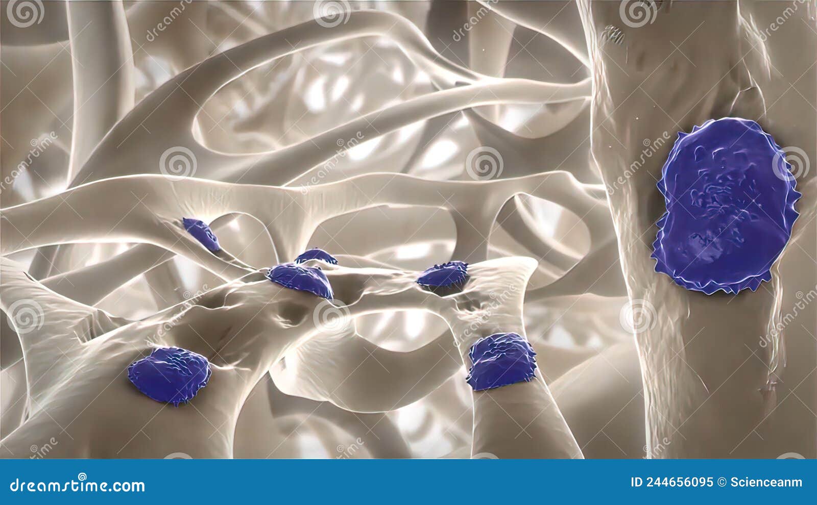 Disrupting Bone Structure, Rheumatoid Arthritis Stock Illustration ...