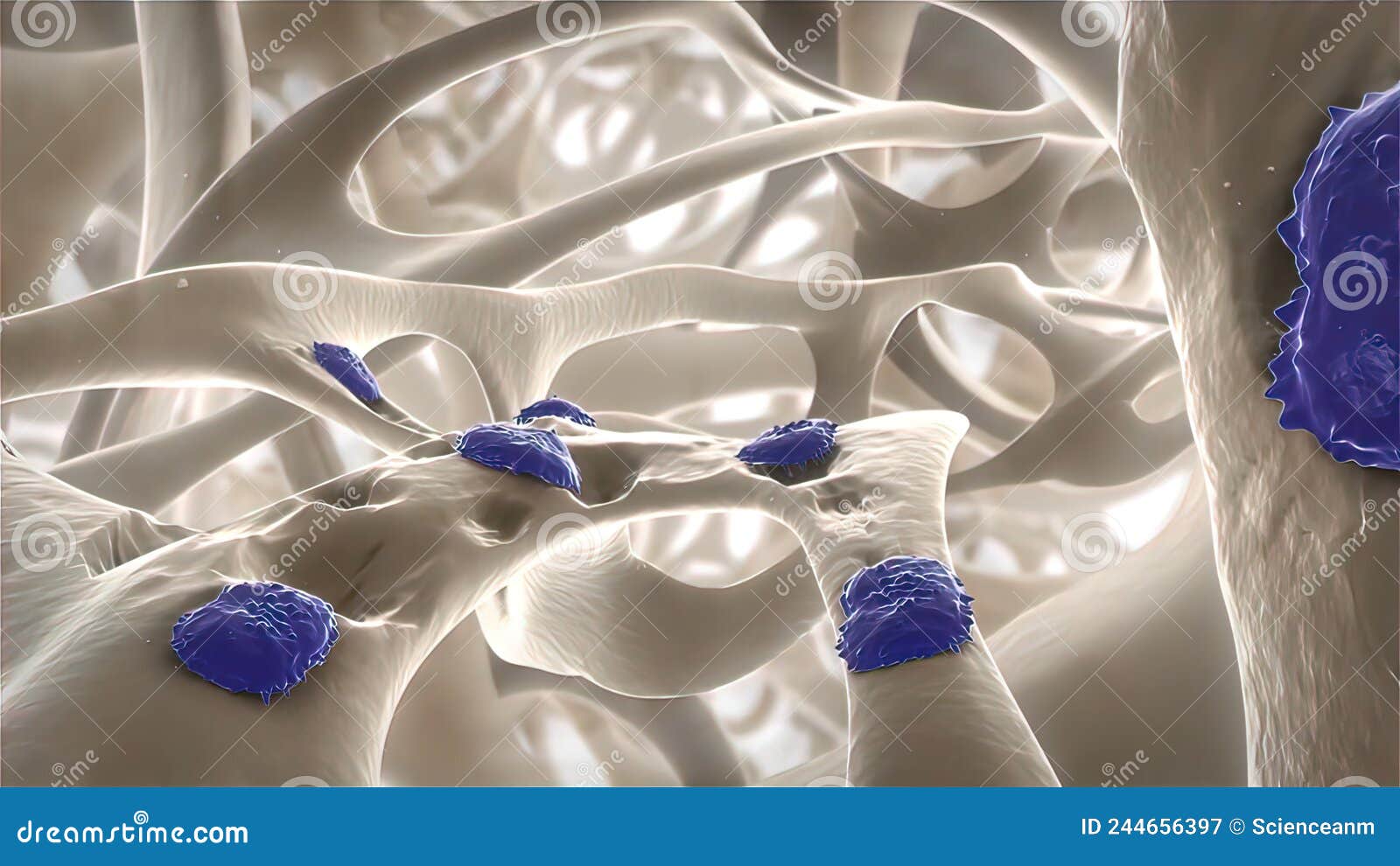 Disrupting Bone Structure, Rheumatoid Arthritis Stock Illustration ...