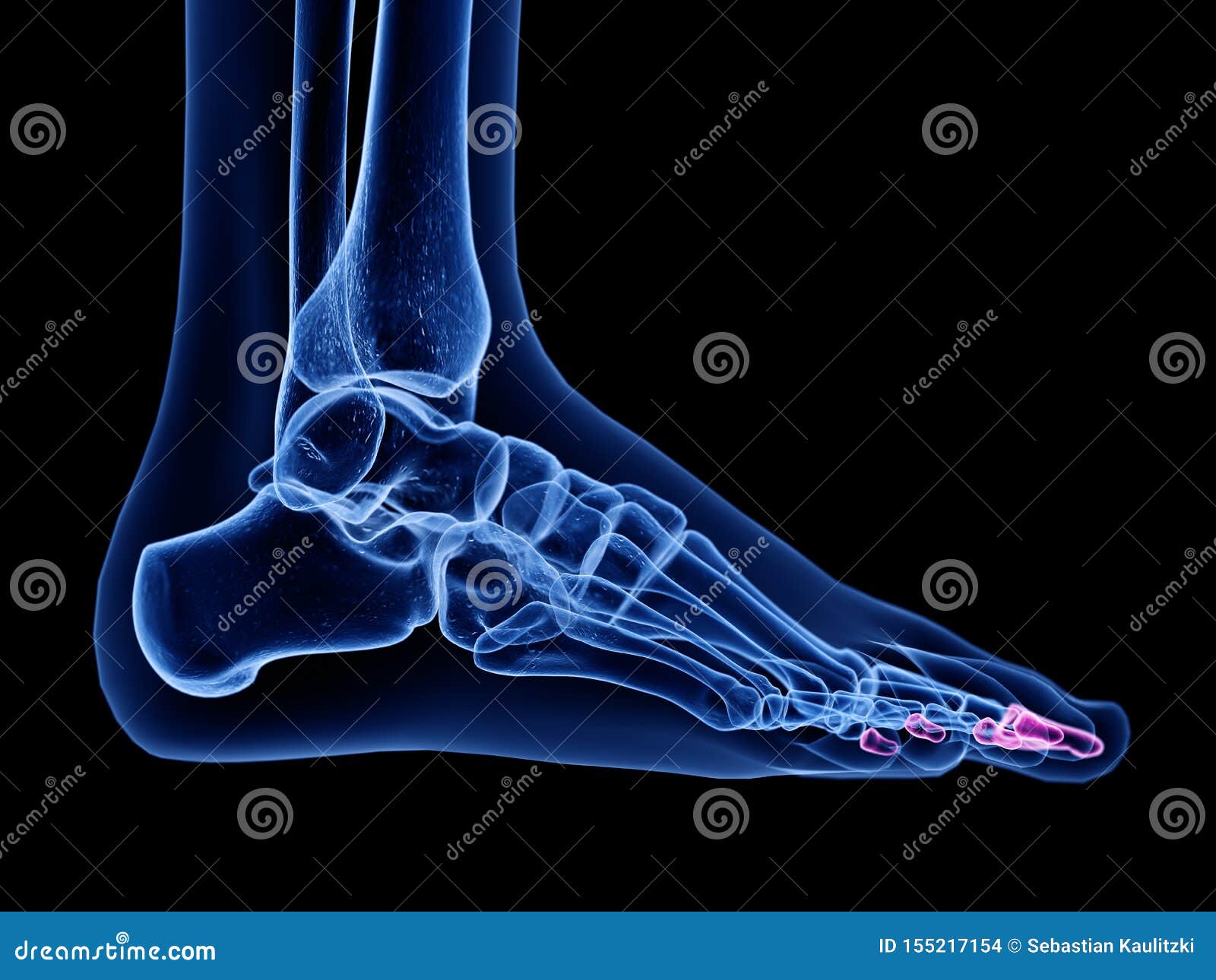 Distal Phalanx Bones In Red Color With Body 3D Rendering Illustration ...