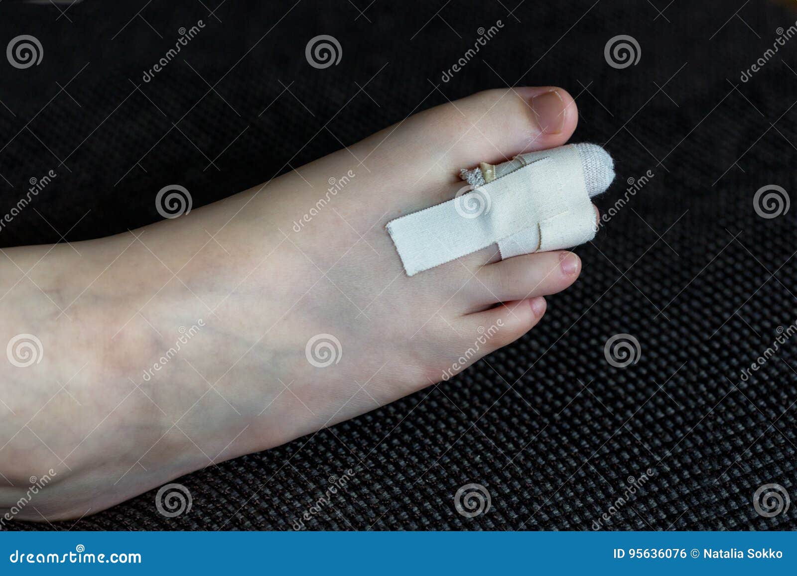 Dito Del Piede E Fasciatura Rotti Fotografia Stock - Immagine di piedi ...