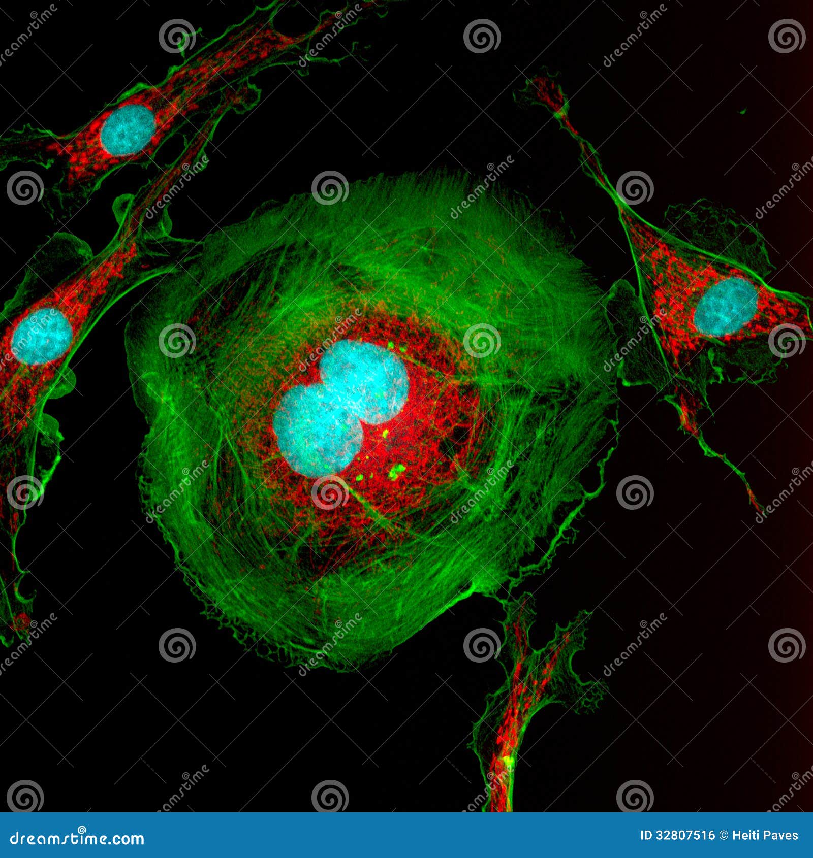 Fibroblaste Photos Stock - Téléchargez 79 Photos libres de droits