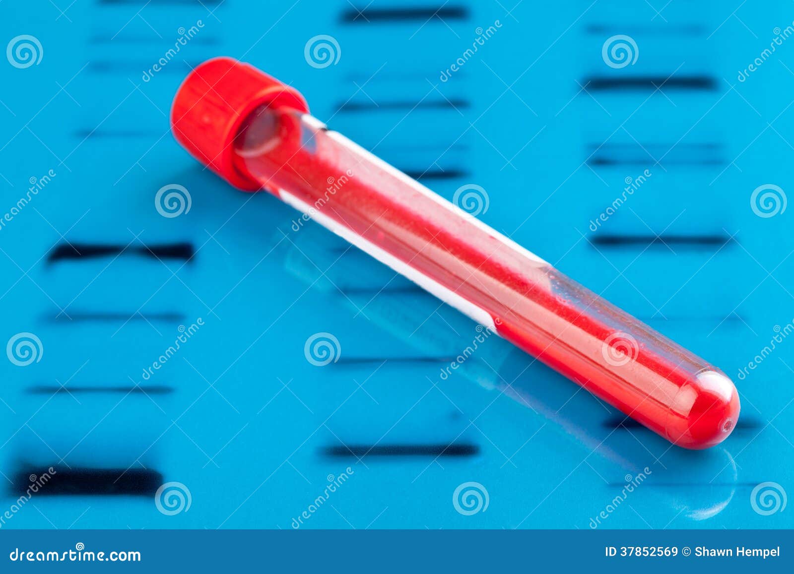 DNA blood sample stock image. Image of industry, equipment - 37852569