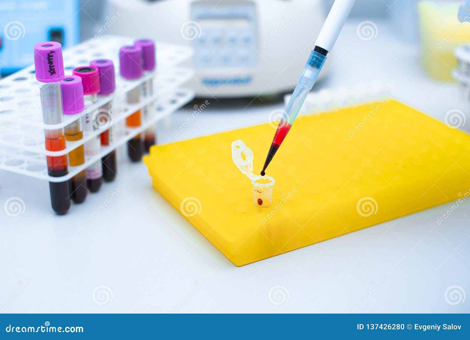 Dna Test in the Lab. Dispenser with Blood and Test Tubes Close-up Stock ...