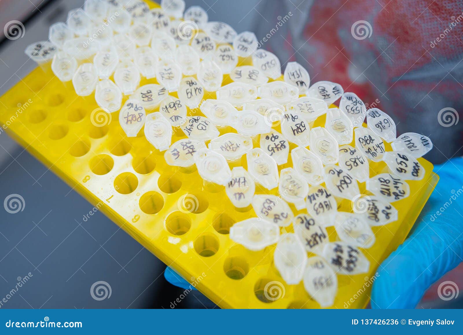 Dna Test in the Lab. Test Tubes with Biomaterials in the Hands of a ...