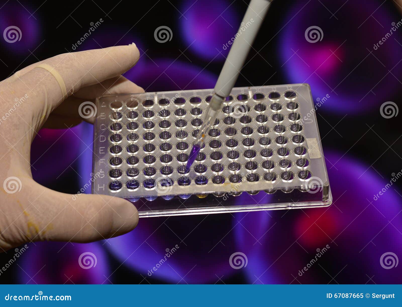 DNA Testing in the Laboratory. Stock Image - Image of dose, equipment ...